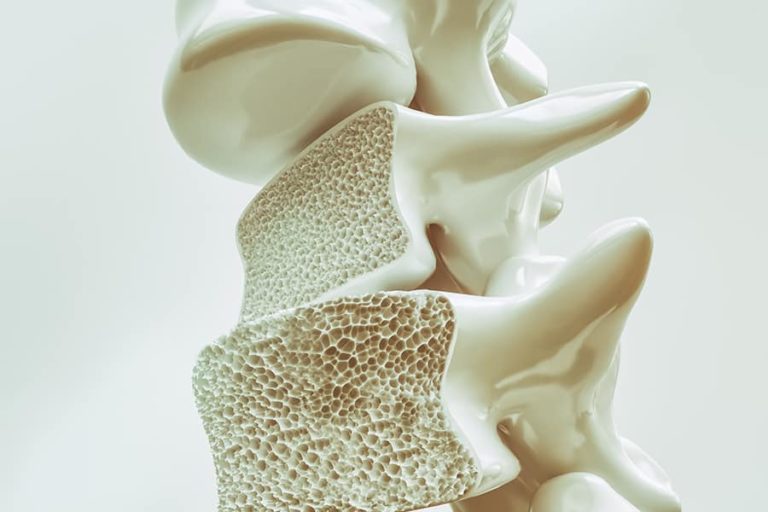 9 ways to improve bone health - Rest Less