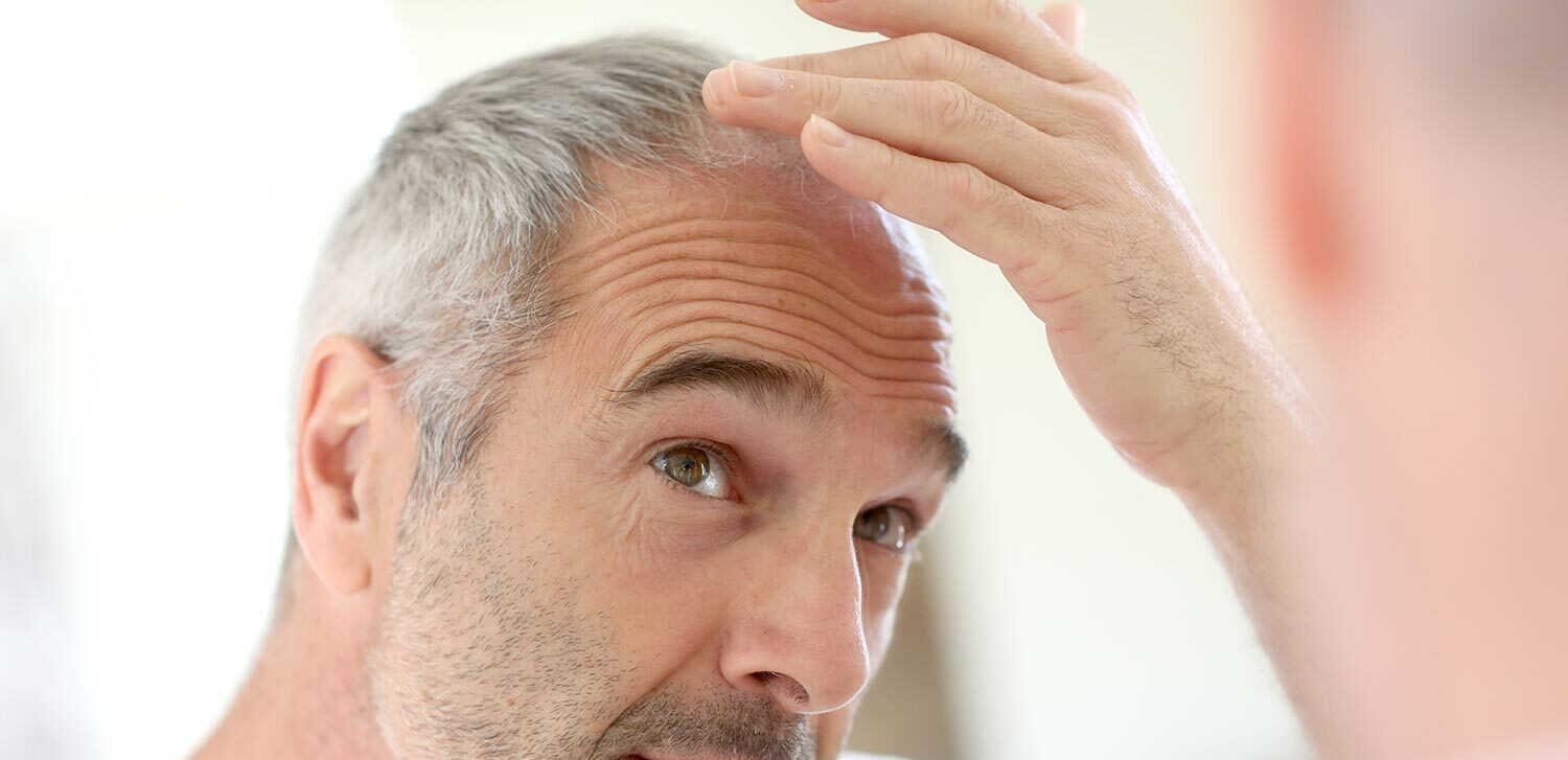 Men's hair loss – causes, treatments, and ways to cope - Rest Less