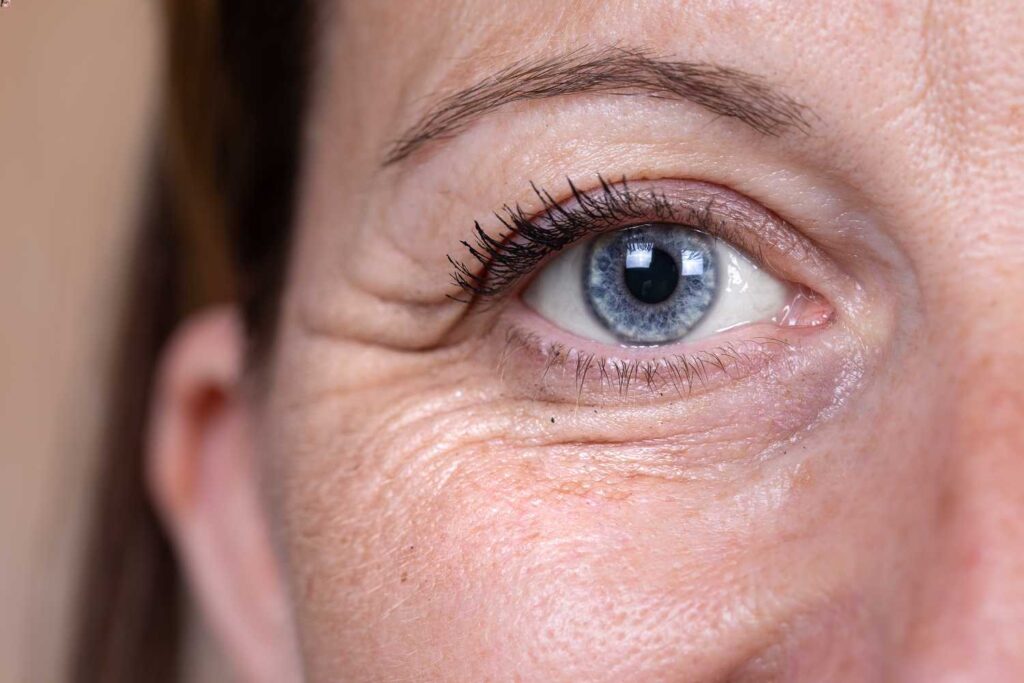 5 eye problems linked with menopause - Rest Less