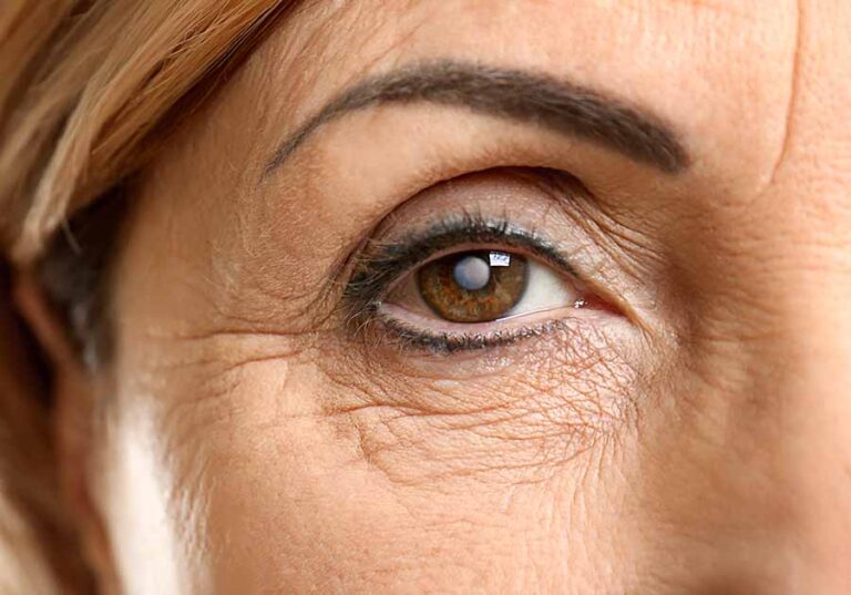 Cataract surgery – your questions answered - Rest Less